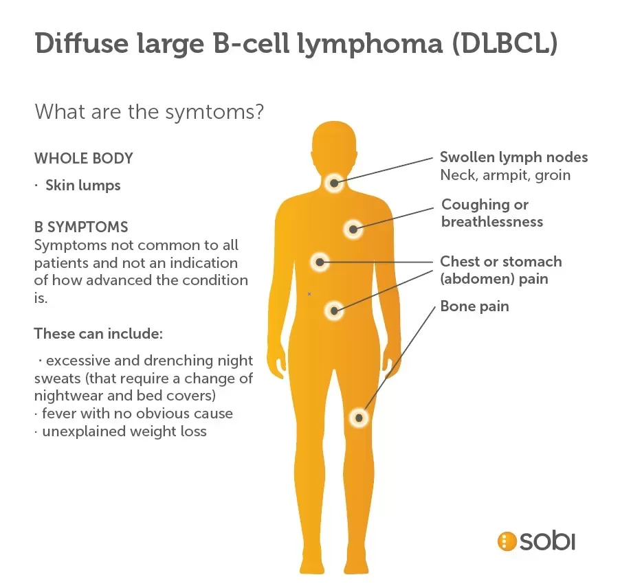 Linfoma diffuso a grandi cellule B (DLBCL) | Sobi Italy